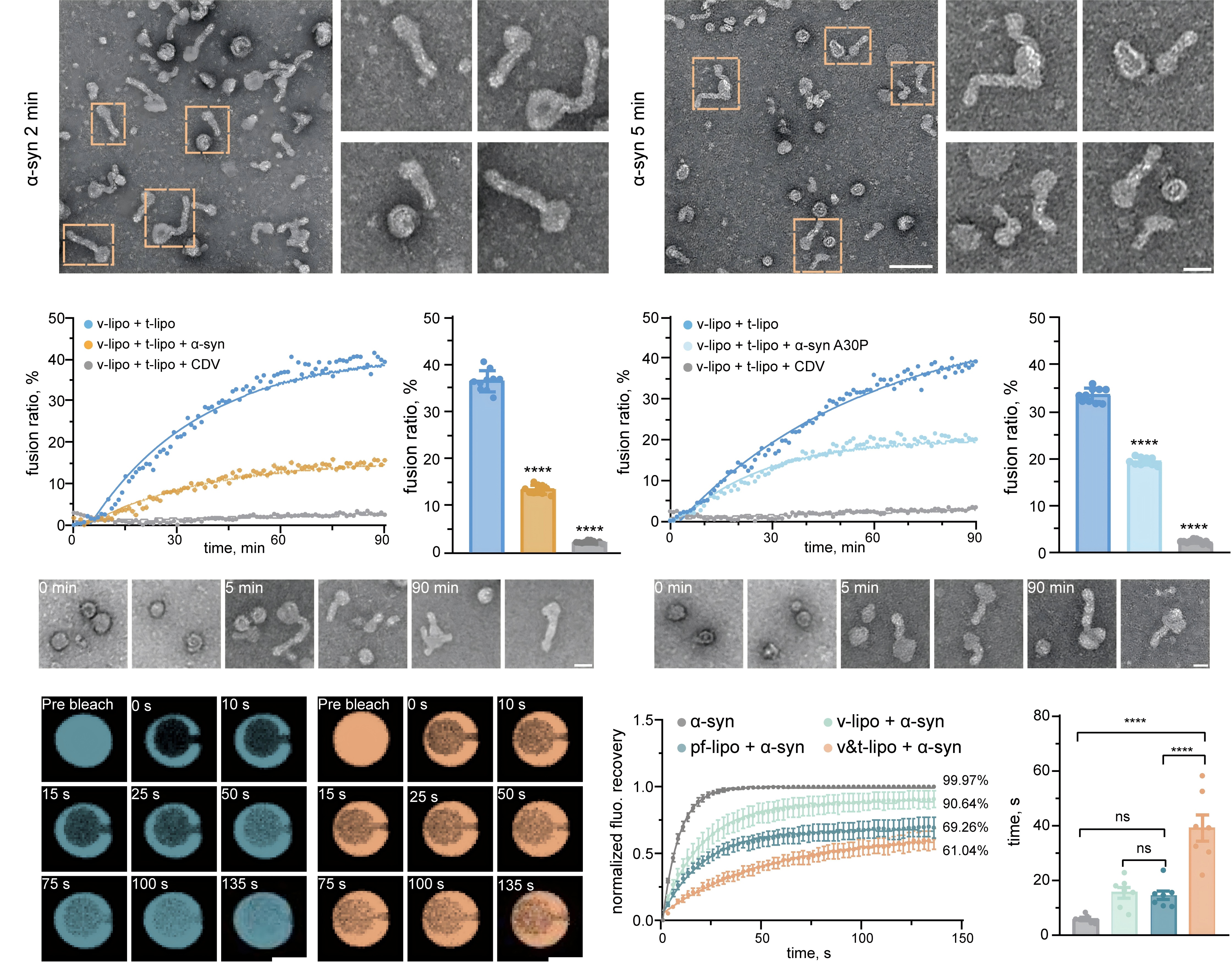 JACS | α-Synuclein协同SNARE蛋白重塑微囊泡结构揭示帕金森新致病机制-中科环渤海（烟台）药物高等研究院